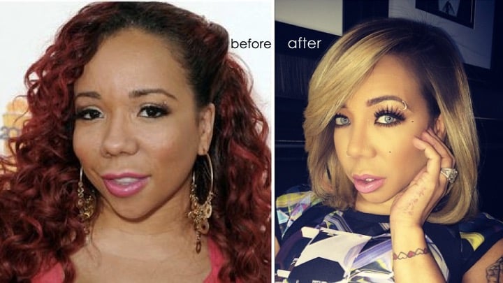 R&B Singer "Tiny" Harris: 10+ Years After Permanent Eye Color Surgery ...