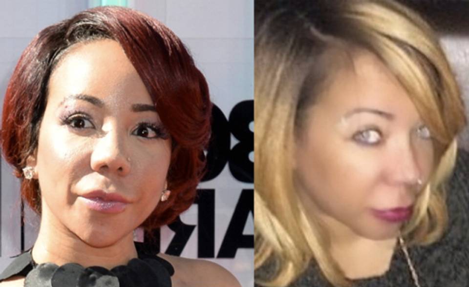 R&B Singer "Tiny" Harris: 10+ Years After Permanent Eye Color Surgery ...