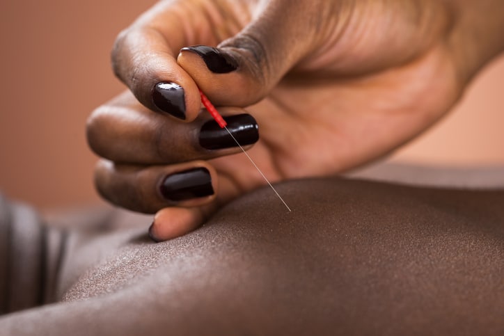 Acupuncture Could Help Ease Hot Flashes - BlackDoctor - Where Culture ...