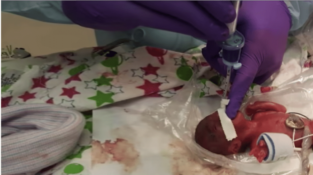 It's A Miracle! World's Smallest Baby Survives! - BlackDoctor - Where ...